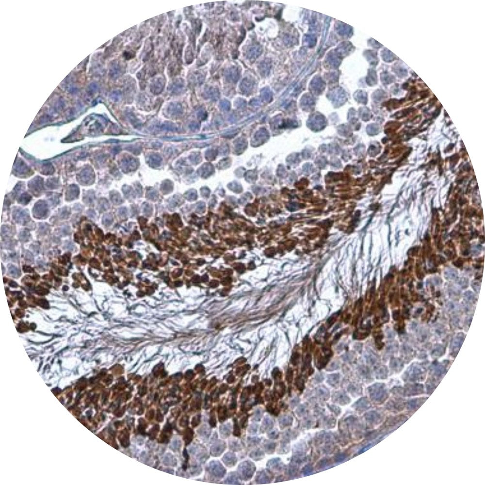 Rankin Basics Control Slides, IHC - Brachuary | Rankin Biomedical
