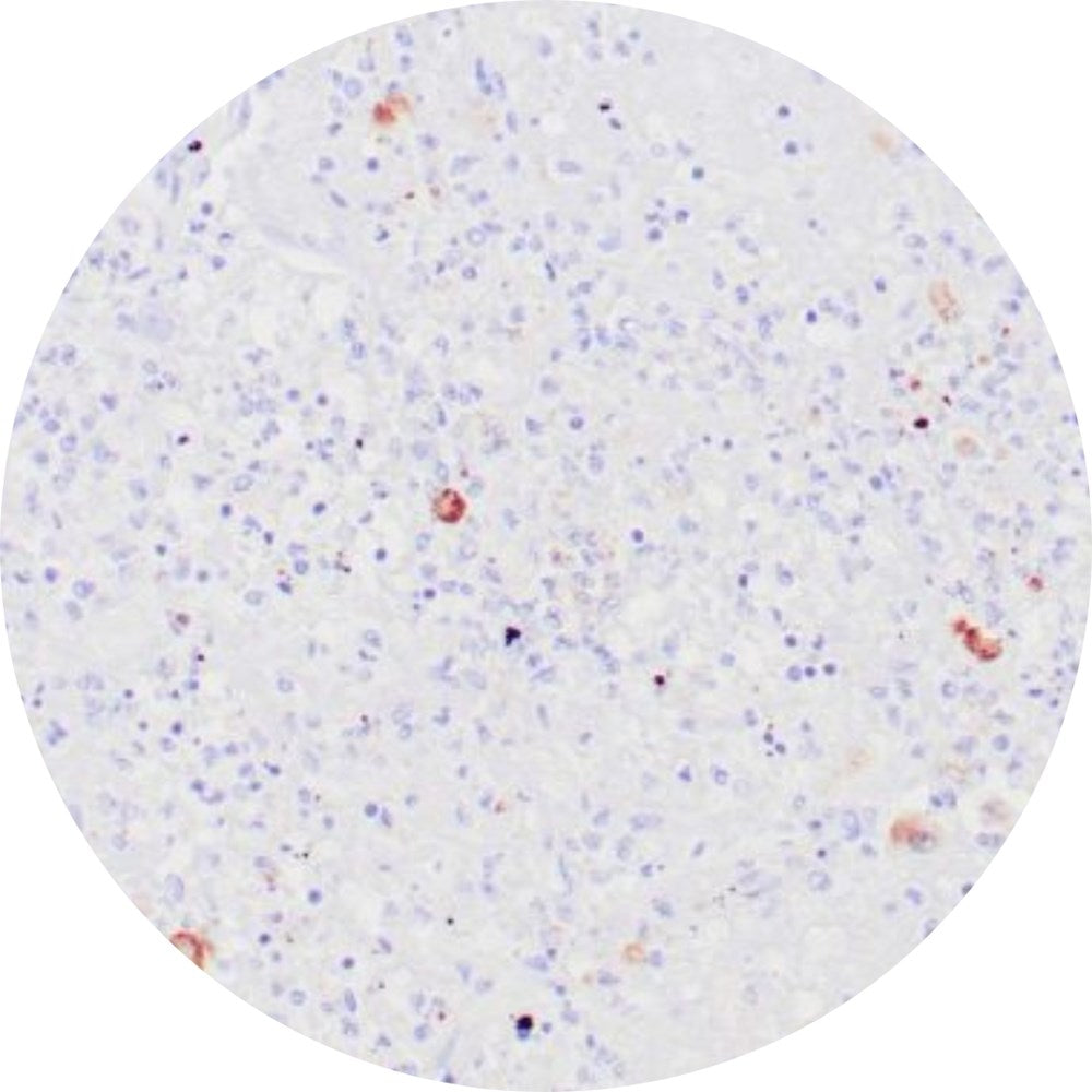 Rankin Basics Control Slides, IHC HSV Type 2 | Rankin Biomedical