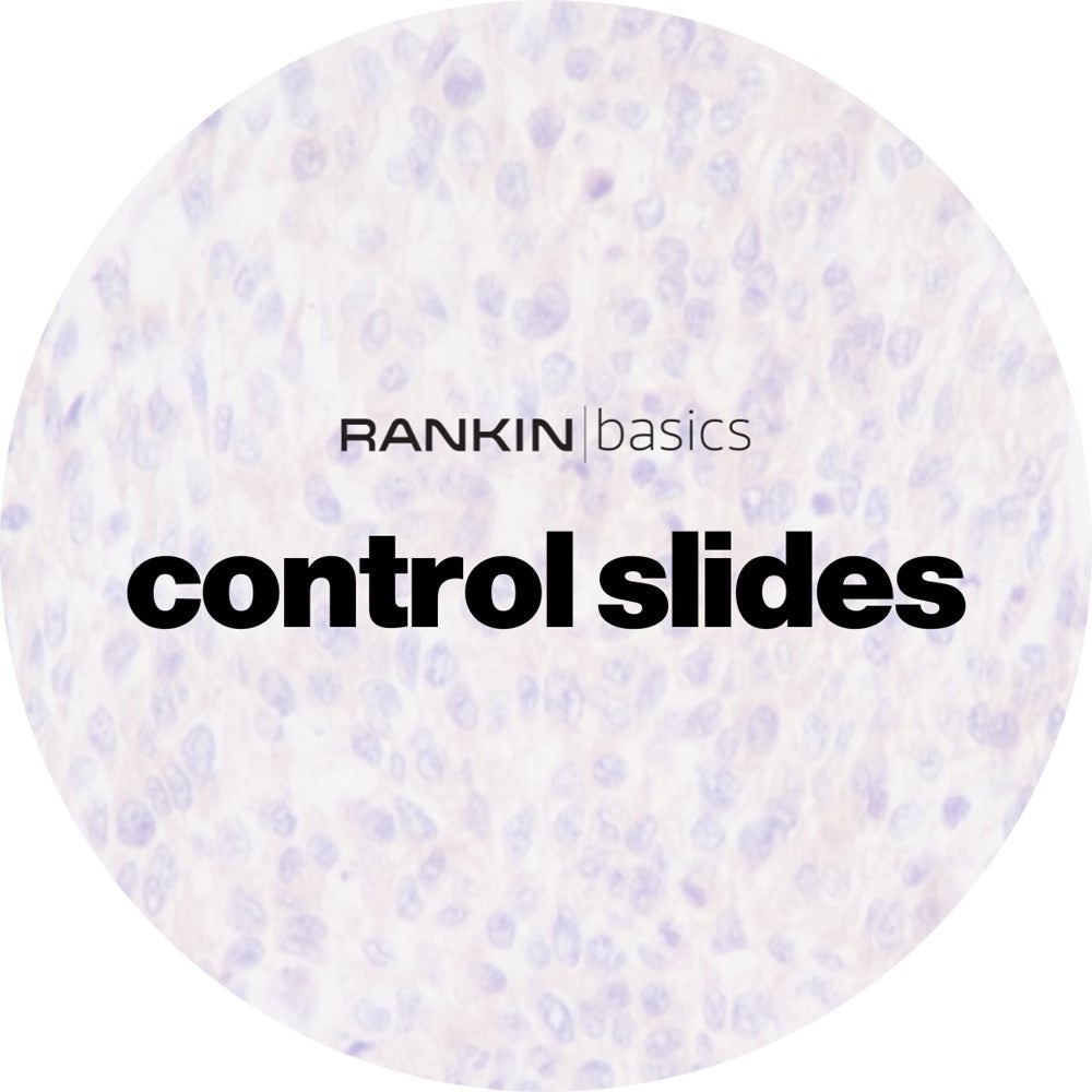 Rankin Basics Control Slides, IHC - Uroplakin III | Rankin Biomedical